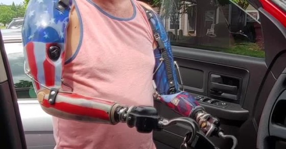 Amputee Shows How to do a Drive Through - Sharedots