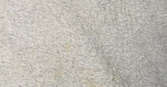 Yellow Dots From Leaking Weiner - Sharedots