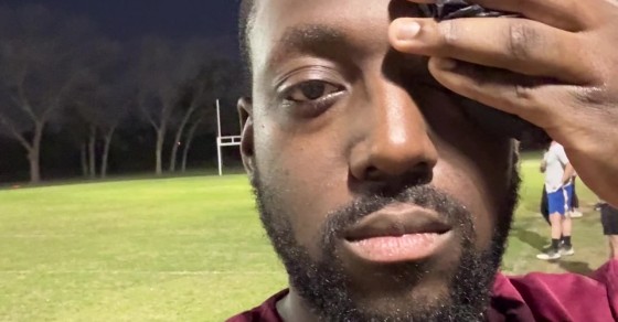 Surprising Injury After Flag Football Collision - Sharedots